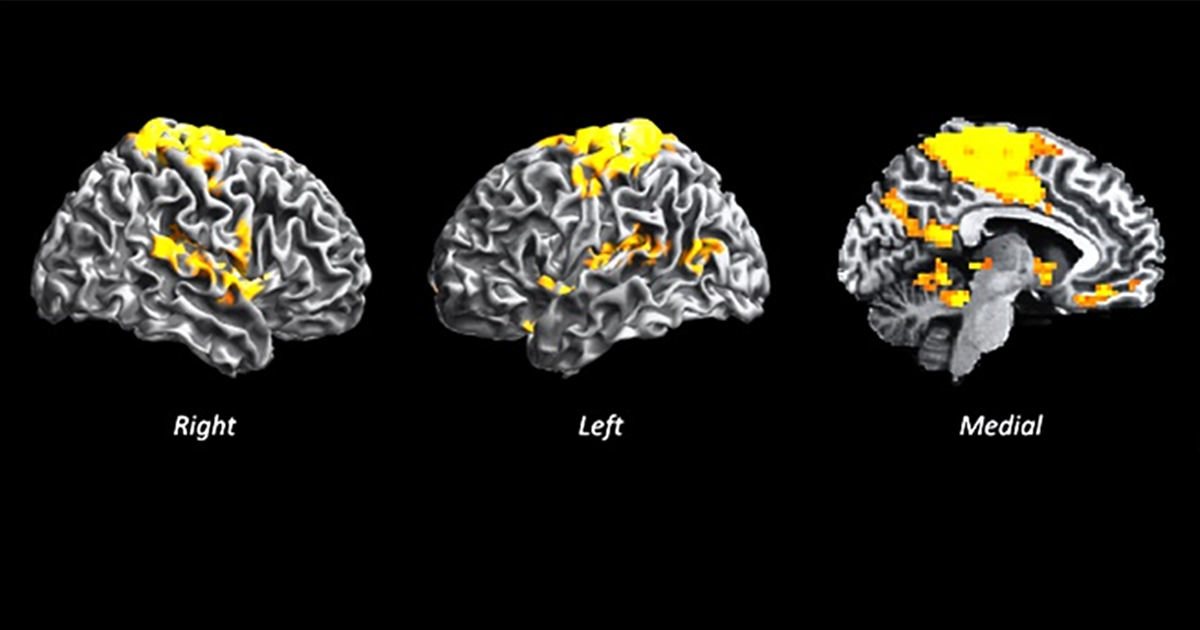 Pinpointing the role of language disruptions in psychosis - Robarts ...